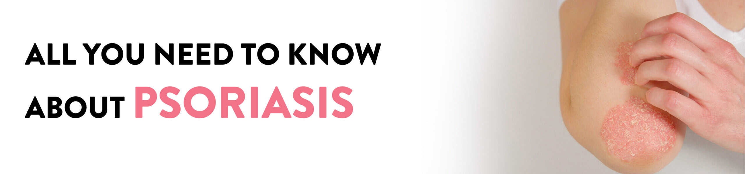 Psoriasis Types Causes And Symptoms And Treatment Ck Birla Hospital