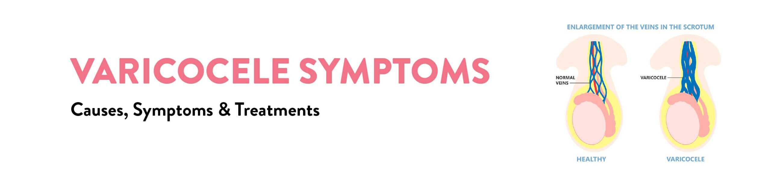 Varicocele Symptoms Causes And Treatment Ck Birla Hospital